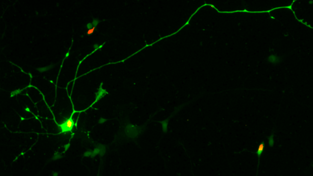 Columbia Stem Cell Initiative - CSCI
