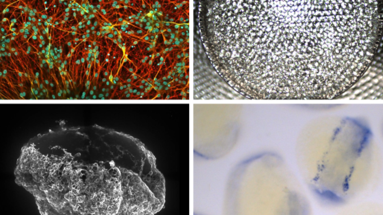Announcing the 2022 CSCI Photo Contest Winners | Columbia Stem Cell ...