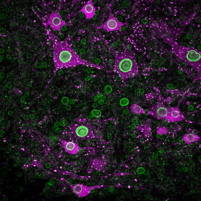 Announcing the 2023 CSCI Photo Contest Winners | Columbia Stem Cell ...