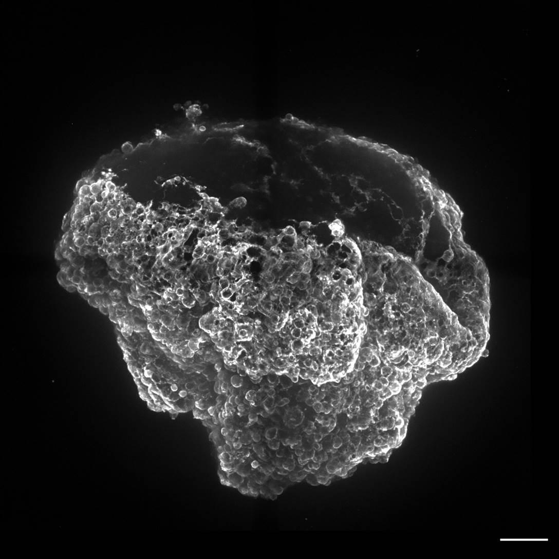 Announcing the 2022 CSCI Photo Contest Winners | Columbia Stem Cell ...