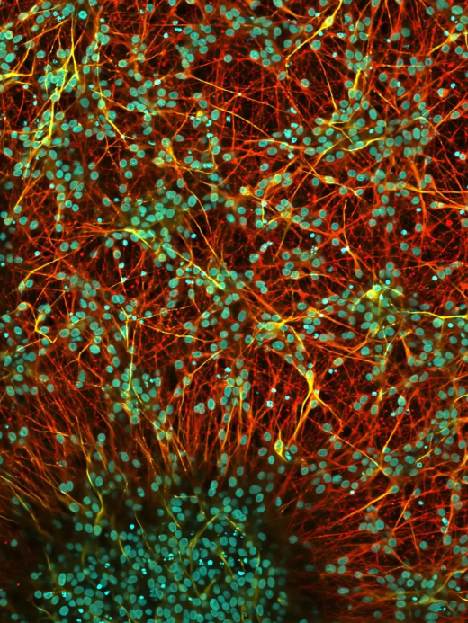 Announcing the 2022 CSCI Photo Contest Winners | Columbia Stem Cell ...